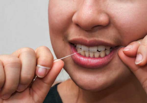 Apa itu Flossing Gigi dan Cara Melakukannya